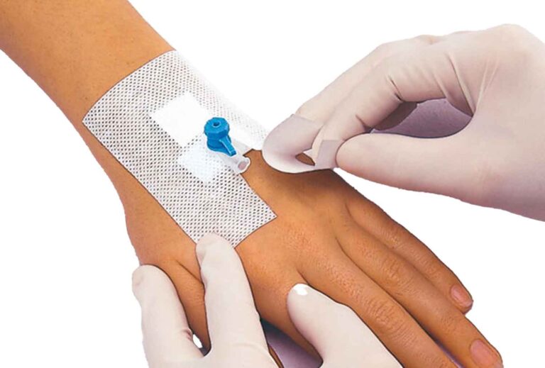 GEN IV FIX – ApexGen